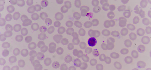 Methylene blue found to kill malaria parasites in record time